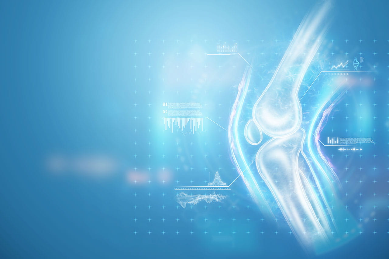 Additive Manufacturing of Orthopedic Medical Implants | TÜV SÜD